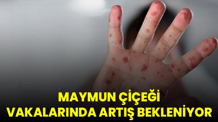 Maymun çiçeği vakalarında artış bekleniyor - Gaziantep Haberler ...